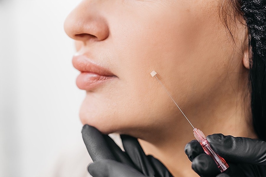 Guide to PDO Thread Lifts | #1 Medspa in Navarre, FL